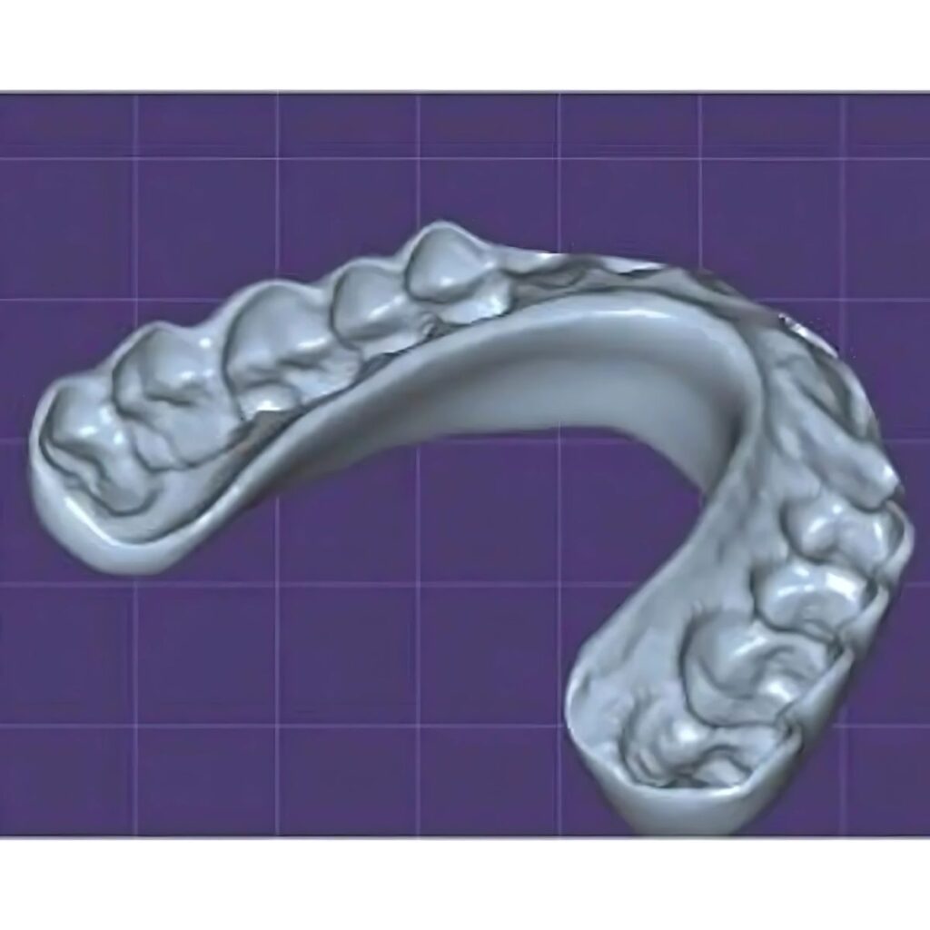Dental Splint Design Service | Professional CAD/CAM